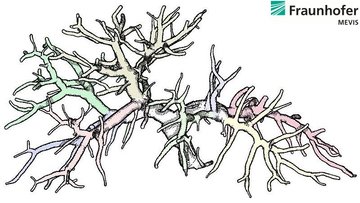 MeVisLab: Screenshots