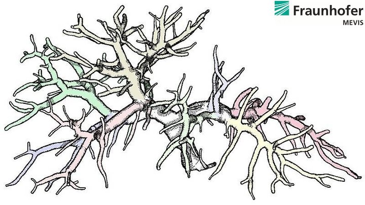 MeVisLab: Screenshots