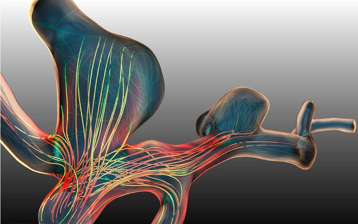 MeVisLab: Screenshots