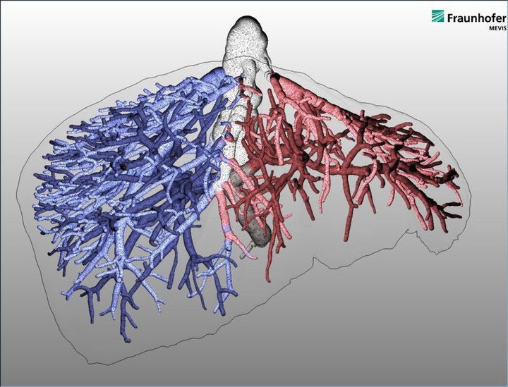 MeVisLab: Open Inventor