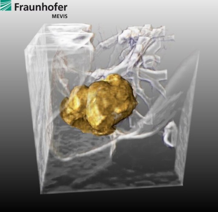 MeVisLab: Screenshots