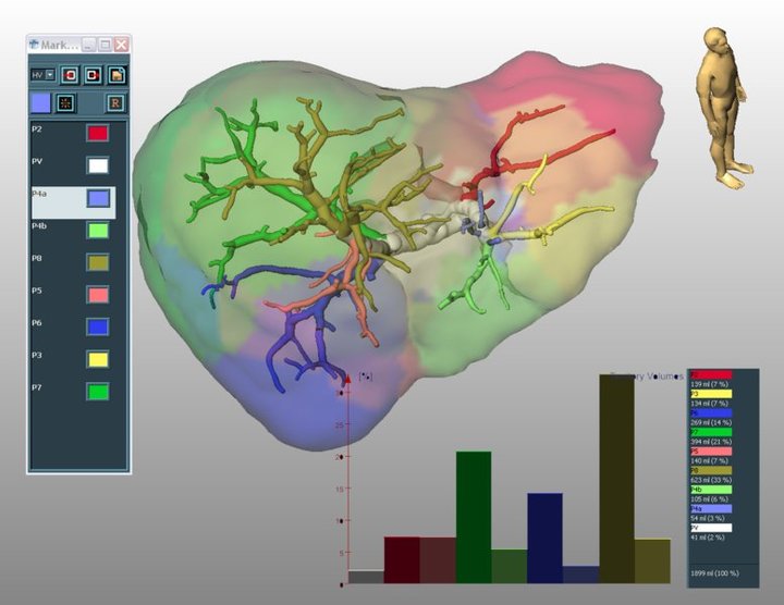 MeVisLab: Open Inventor