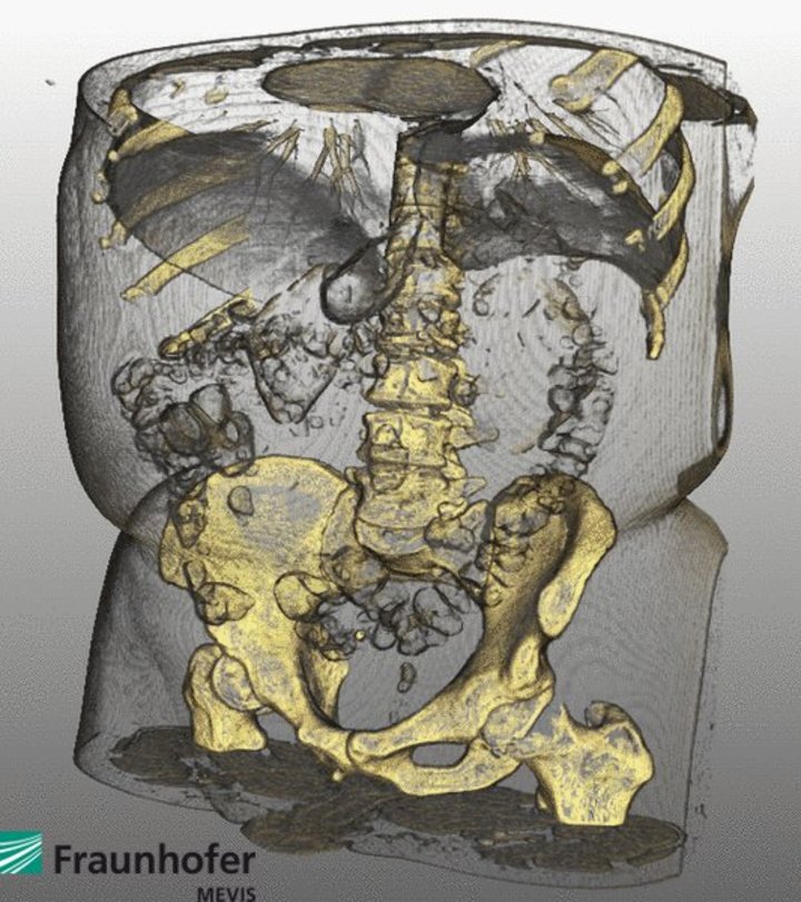 MeVisLab: Screenshots