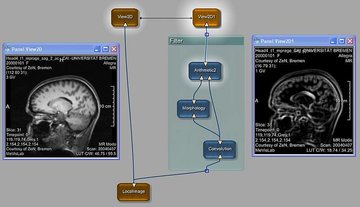 MeVisLab: Image Processing