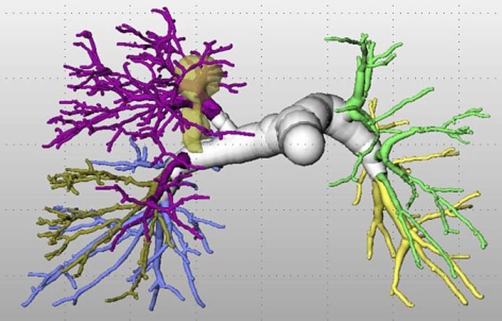 MeVisLab: Screenshots