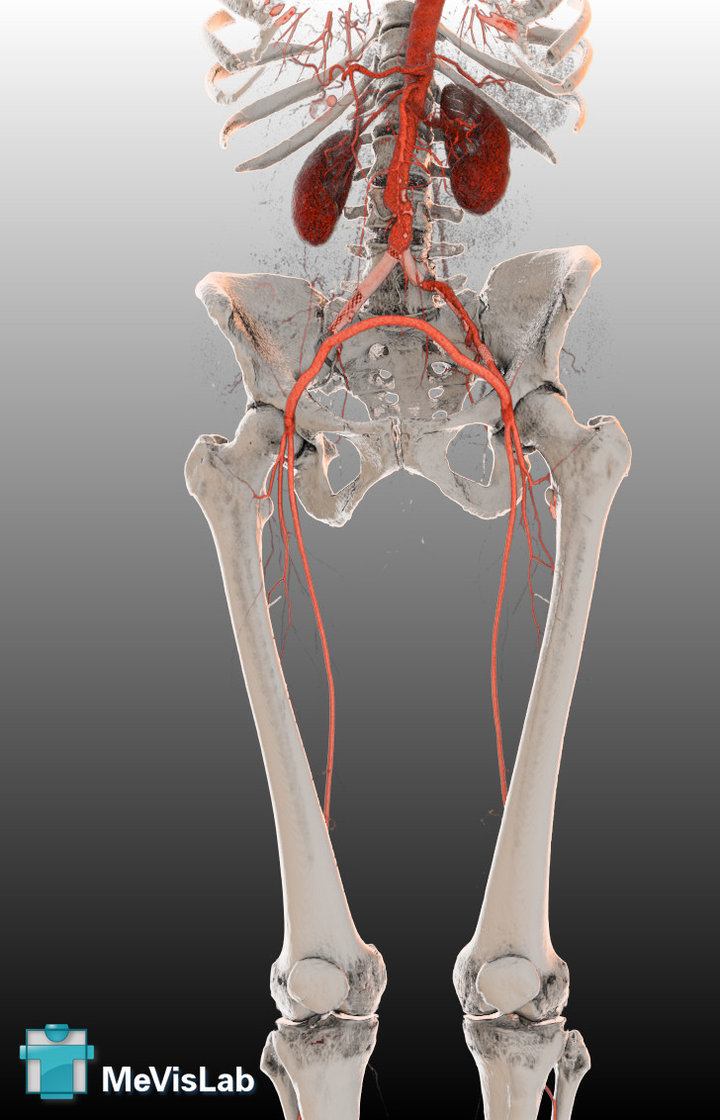 MeVisLab: MeVis Path Tracer Screenshots