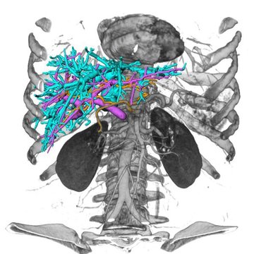MeVisLab: Screenshots
