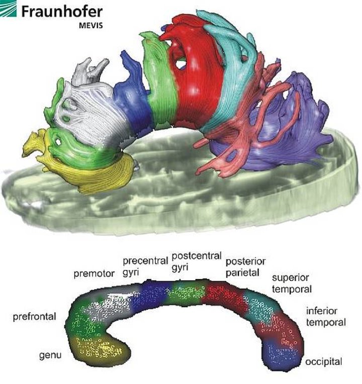 MeVisLab: Screenshots