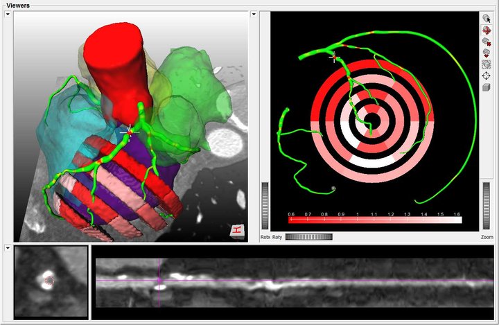 MeVisLab: Screenshots