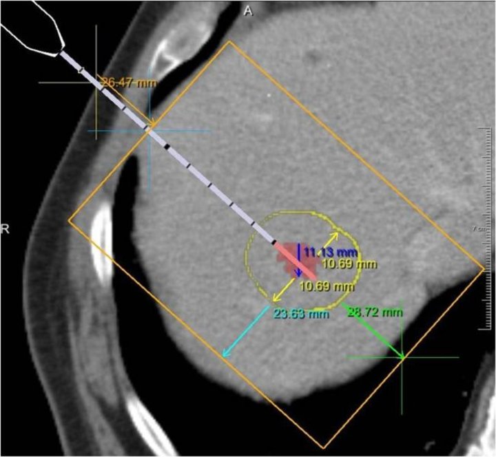 MeVisLab: Visualization