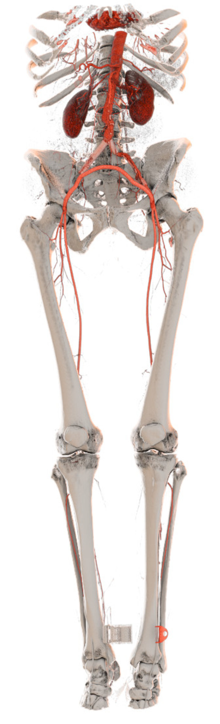 MeVisLab: MeVis Path Tracer Screenshots