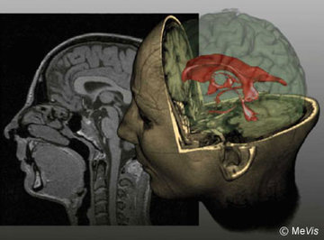 MeVisLab: Screenshots